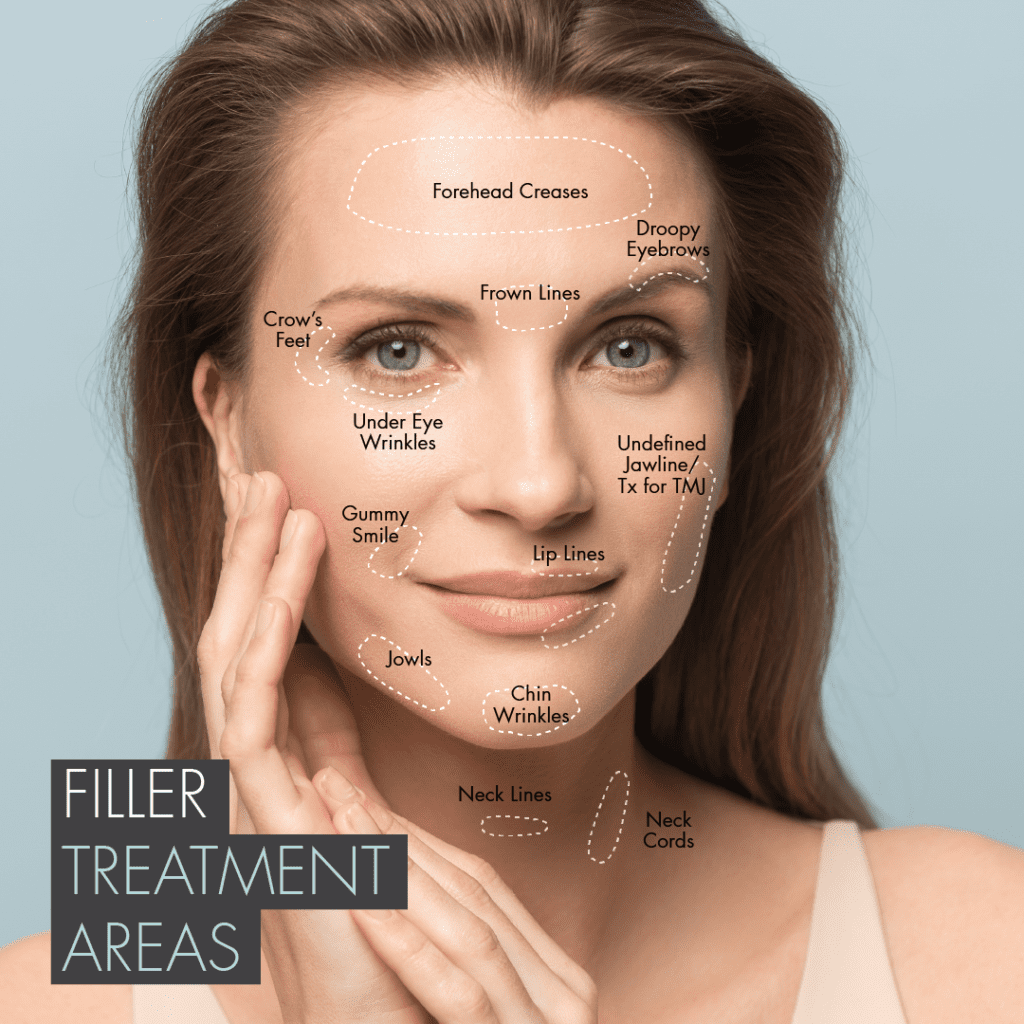How Long Do Fillers Last? & Other FAQs | Red Mountain Weight Loss